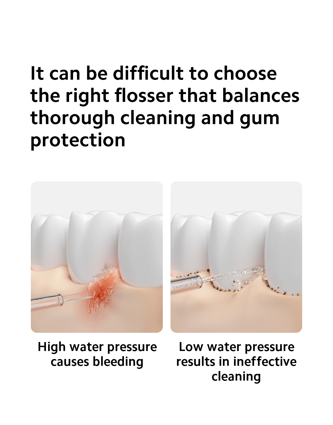 Xiaomi Water Flosser 2 200ml water tank/3 flossing modes/90-day long ...