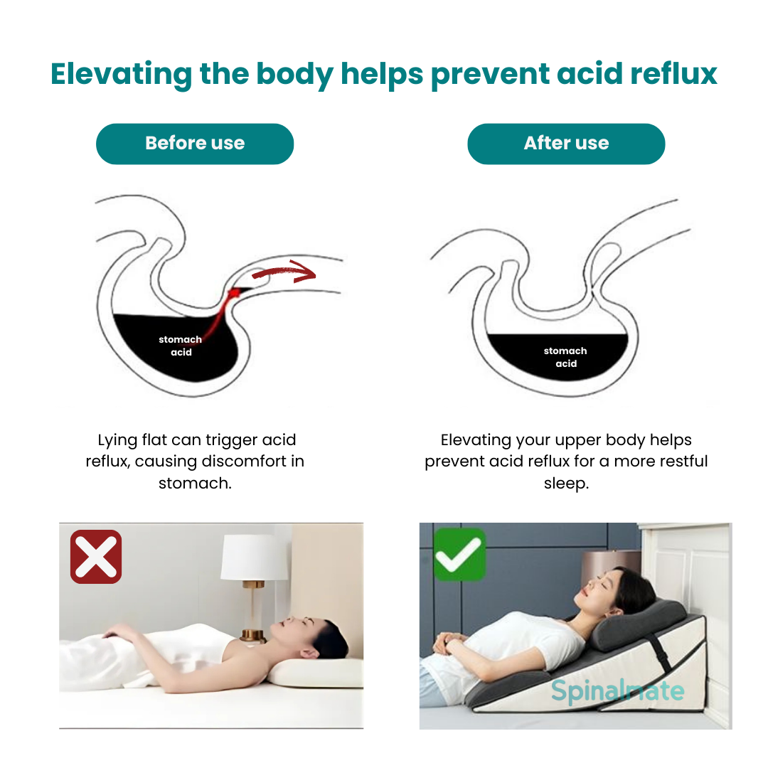Spinalmate Acid Reflux 4in1 Wedge Pillow GERD Pillow Backrest Sleeping ...