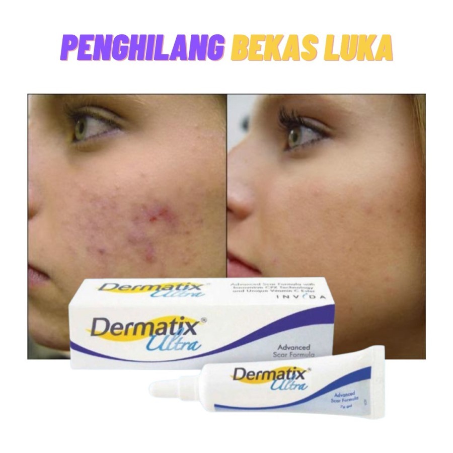 Original Dermatix ultra Scar Gel 15g,Dermatic Acne Scar Reduction Cream ...