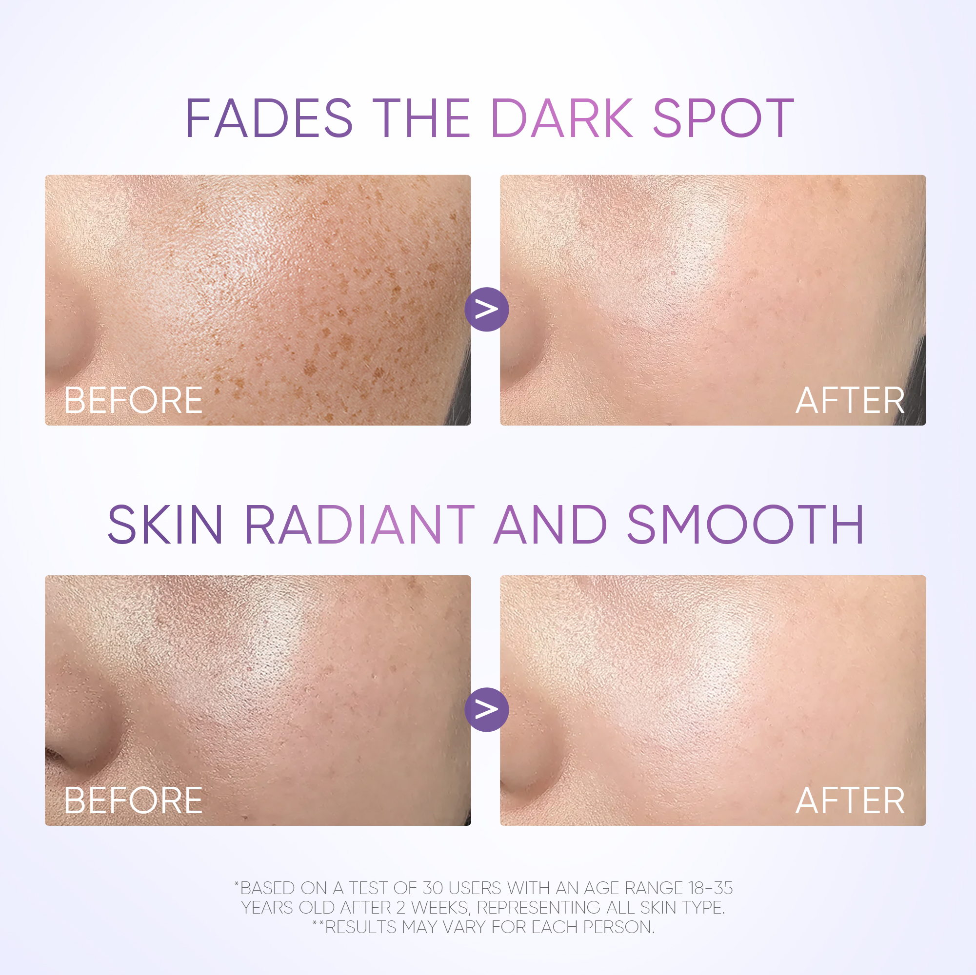 SKINTIFIC Sym White 377 Dark Spot Serum muka with Niacinamide ...