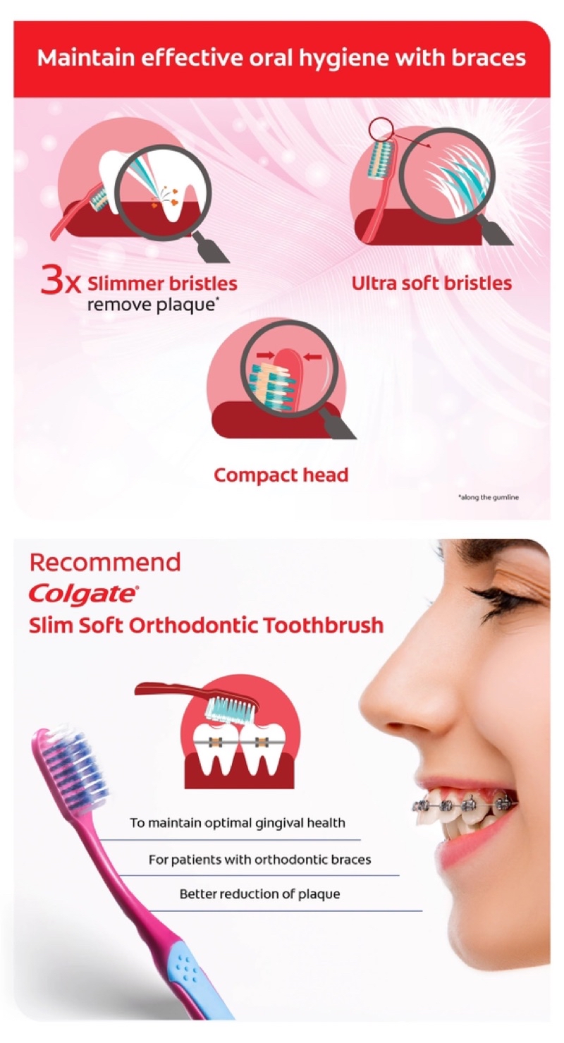 Colgate Orthodontic Braces Soft toothbrush 绑牙牙刷 berus gigi untuk ...