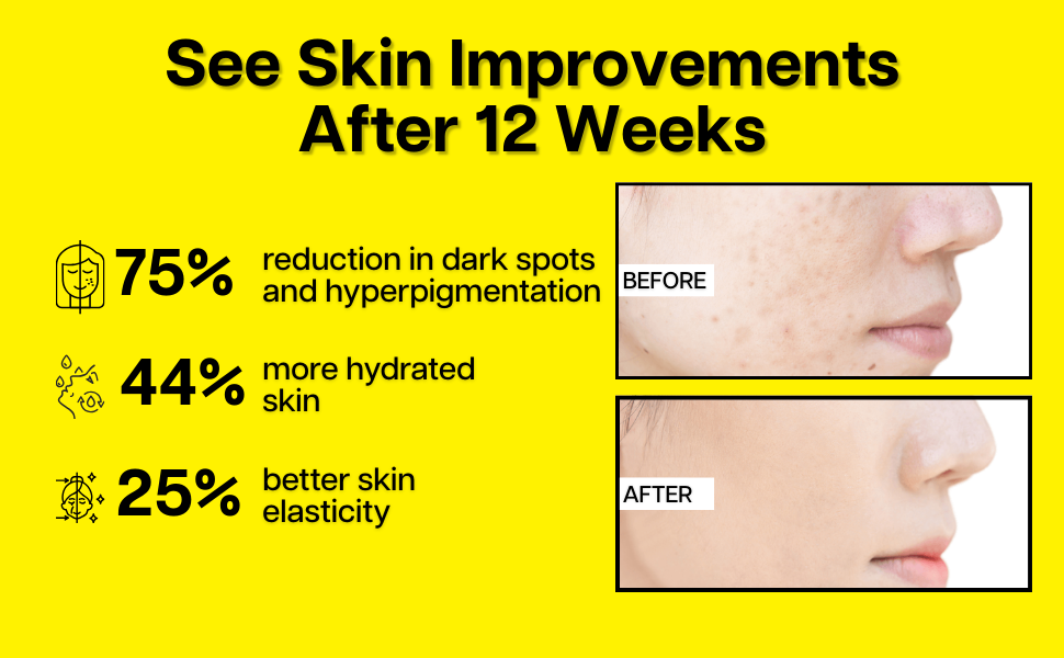 Ventamin LIGHT UP Skin Brightening Pigment Jeragat Oral Supplement Fern ...
