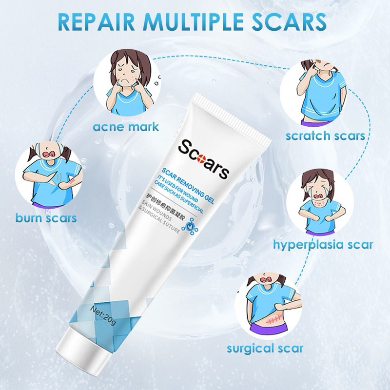 Scar reducing ointment Repair Lighten Acne Pits Stretch Marks Scar ...
