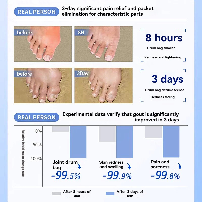 mitsui gout patch joint pain relief patch ubat gout sakit lutut dan ...