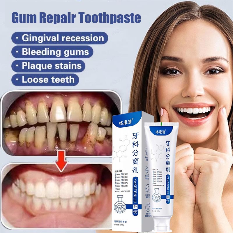 Dental Separating Agent 100g gum repair toothpaste Pasta Gigi Perbaikan ...