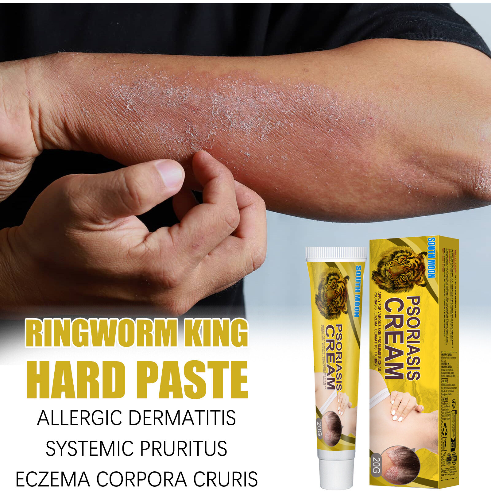 South Moon Tiger Psoriasis Cream Tiger Label Paste Itching Psoriasis ...