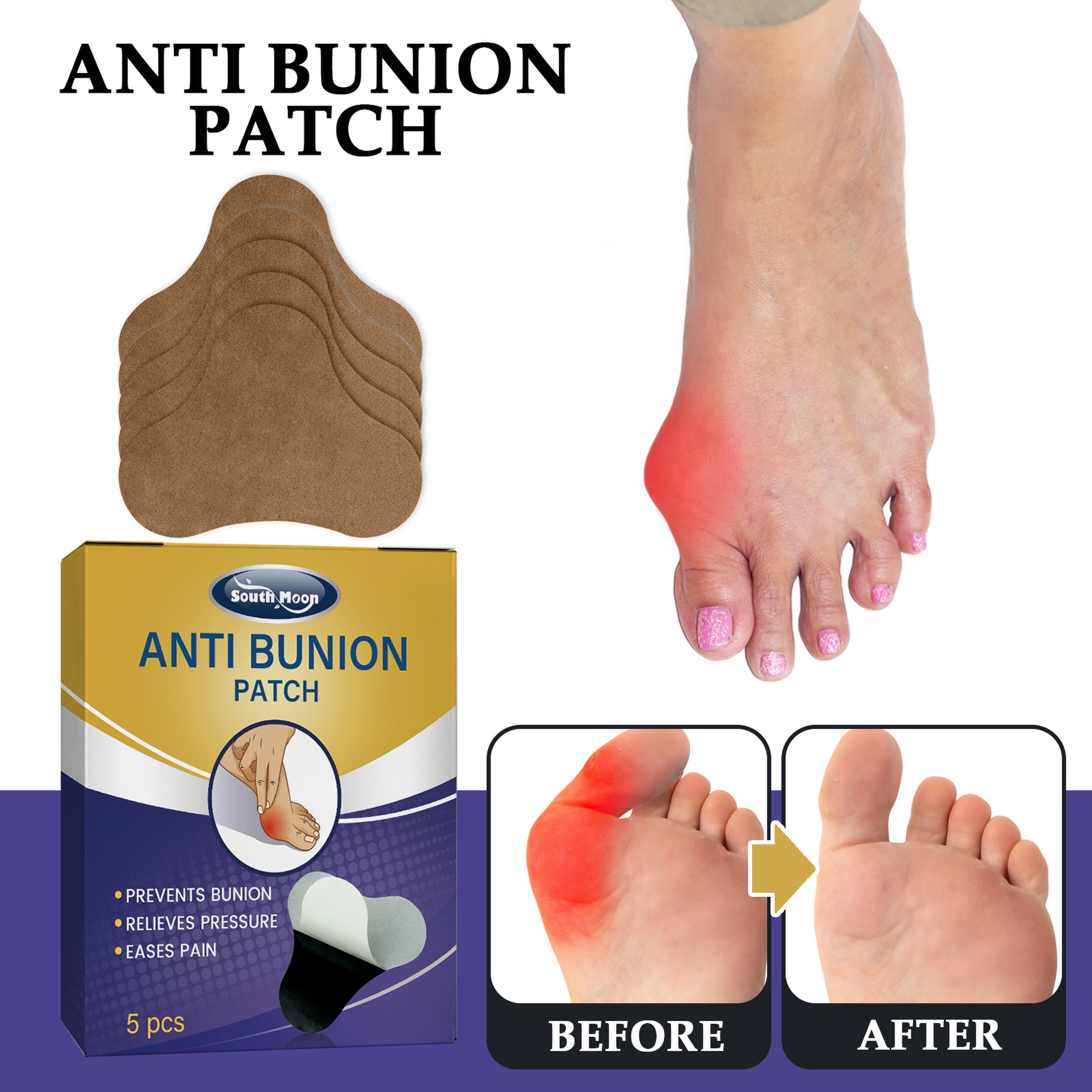 Anti Bunion Patch Finger Bunion Patch Correcting foot swelling and pain ...