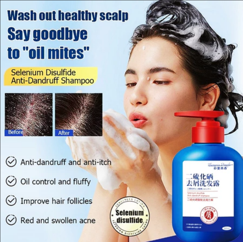 Selenium Disulfide Hair Shampoo 300ml | Anti-Itch, Anti-Dandruff ...