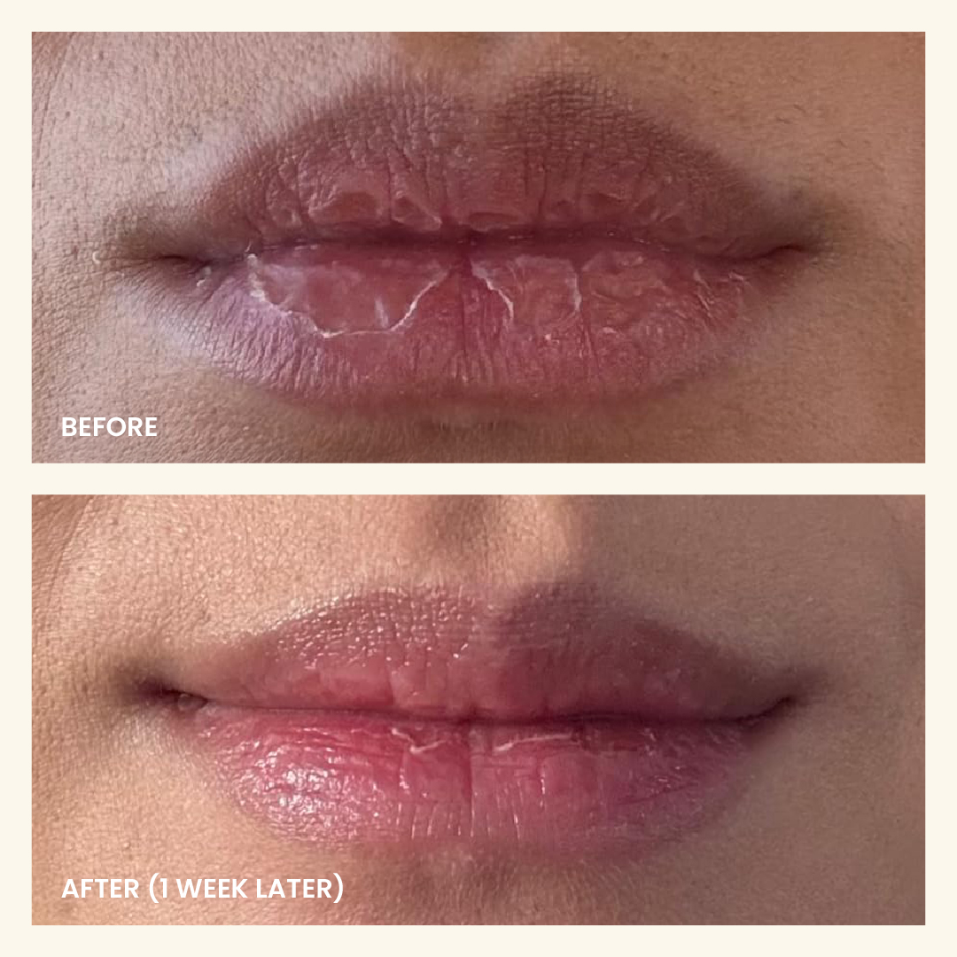 Handmade Heroes Coconut Sorbet Lip Scrub | Smoothens Flaky Lips ...