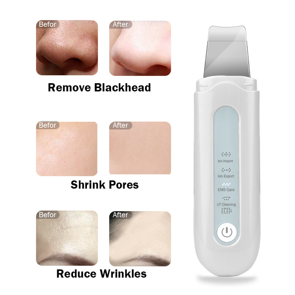 BETTERSELF Ultrasonic Facial Scrubber Blackhead Removal Whitehead ...