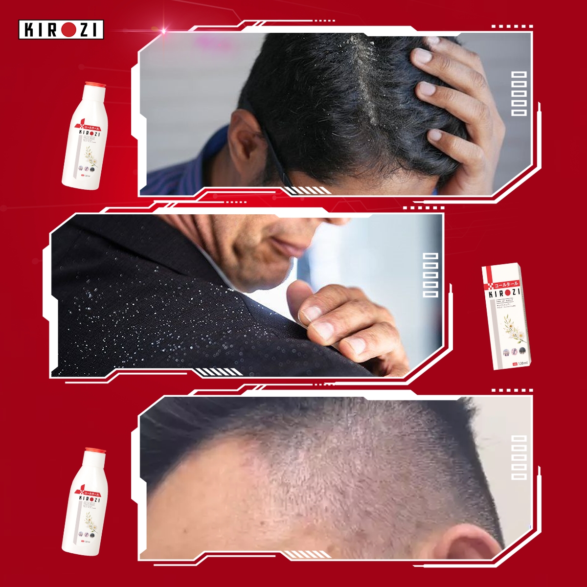 KIROZI Complete Hair Care Combo Kirei Extra Shampoo Herbal + 100HERB ...