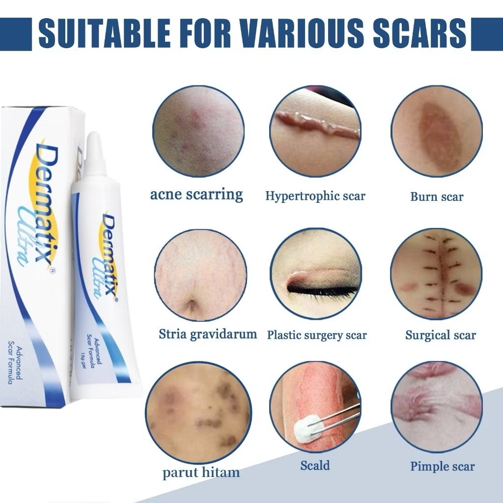 Advanced Scar Treatment Gel for All Scar Types Intense Formula Fades ...