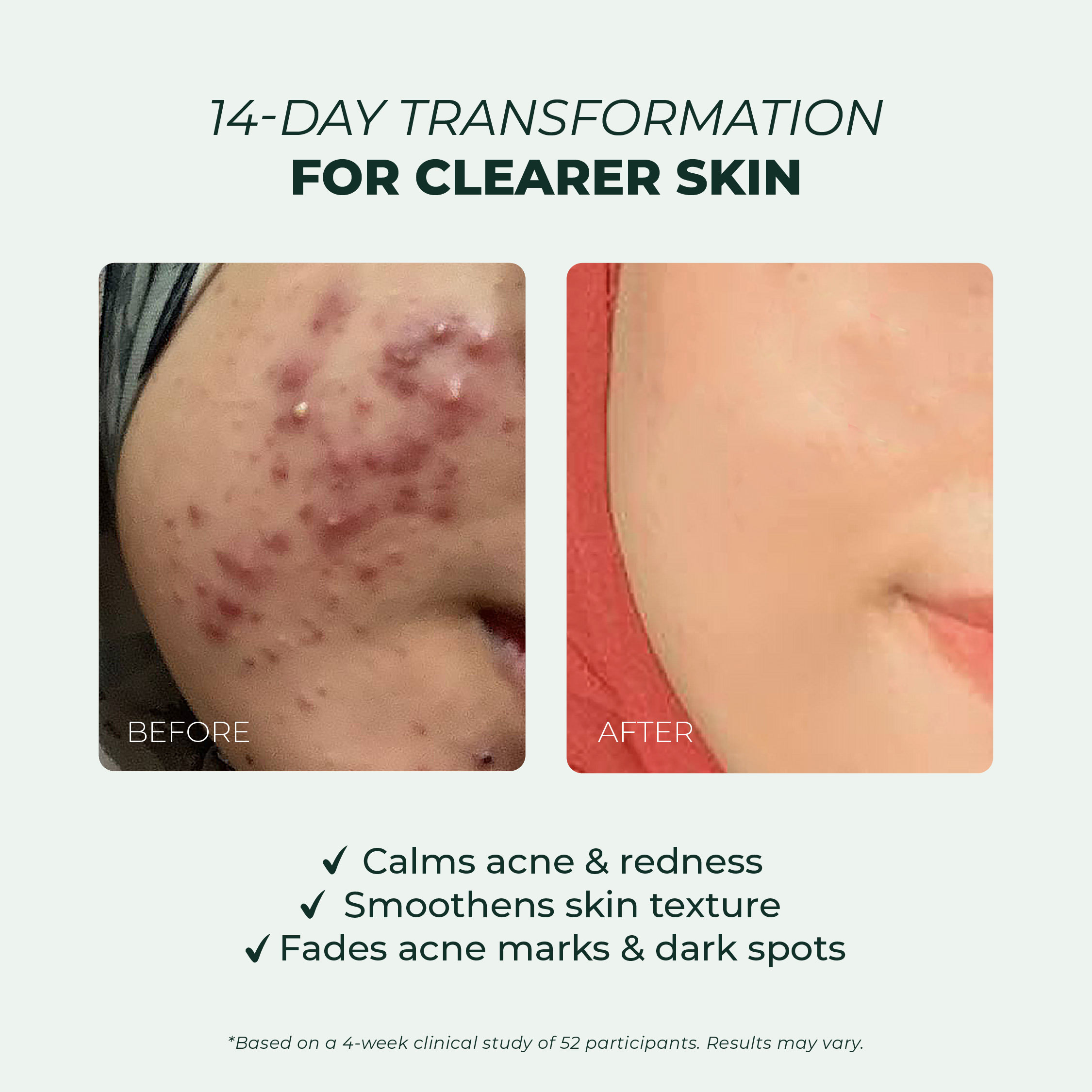 HEALEZ Serum (2 x 5ml) + Cleanser (40ml) | Shopee Malaysia