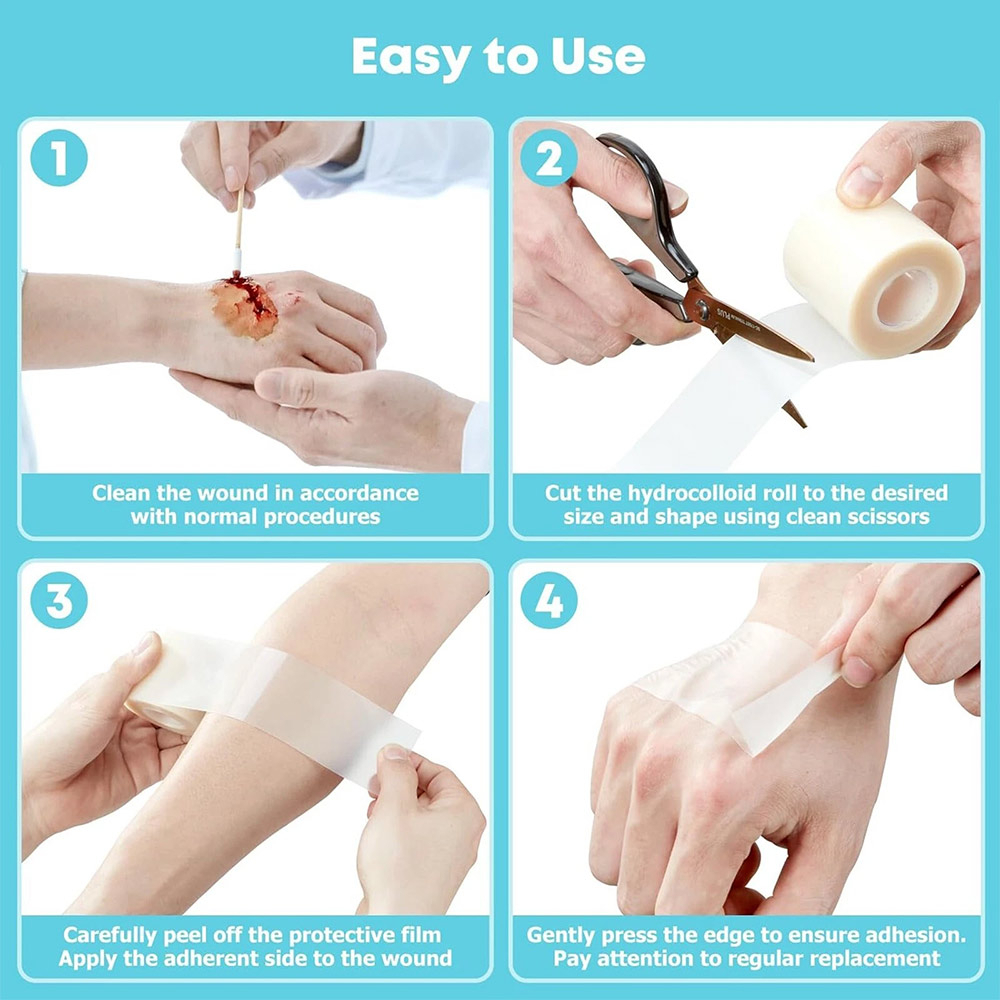 Medical Grade Hydrocolloid Sheet Roll – Cut-to-Fit Dressing for Wound ...