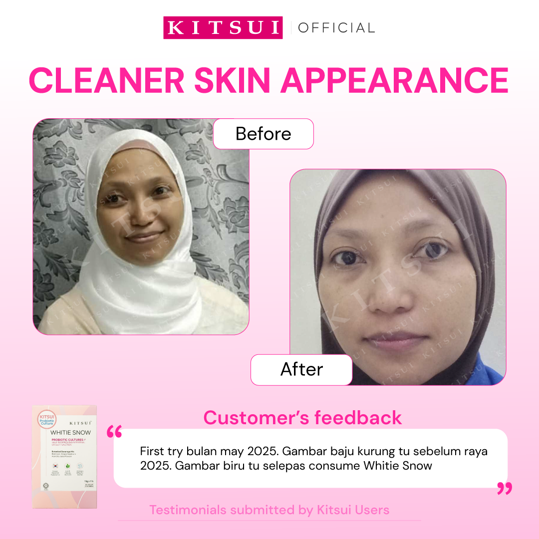 KITSUI Whitie Snow | 17's x 15g - Minuman Beri Probiotik + Niacinamide ...
