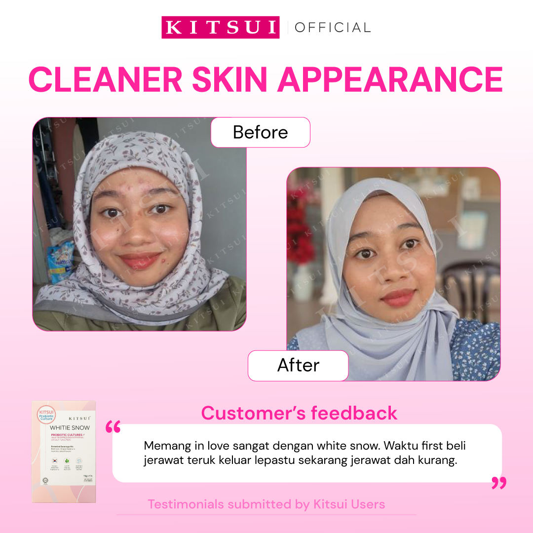 KITSUI Whitie Snow | 17's x 15g - Minuman Beri Probiotik + Niacinamide ...