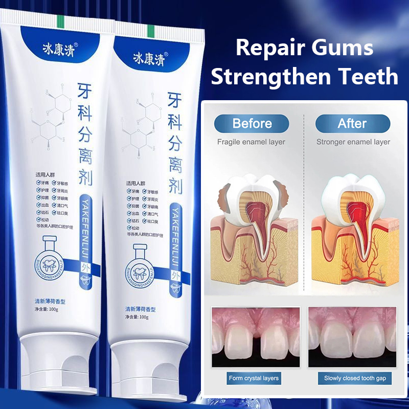 Dental Separating Agent 100g gum repair toothpaste Pasta Gigi Perbaikan ...