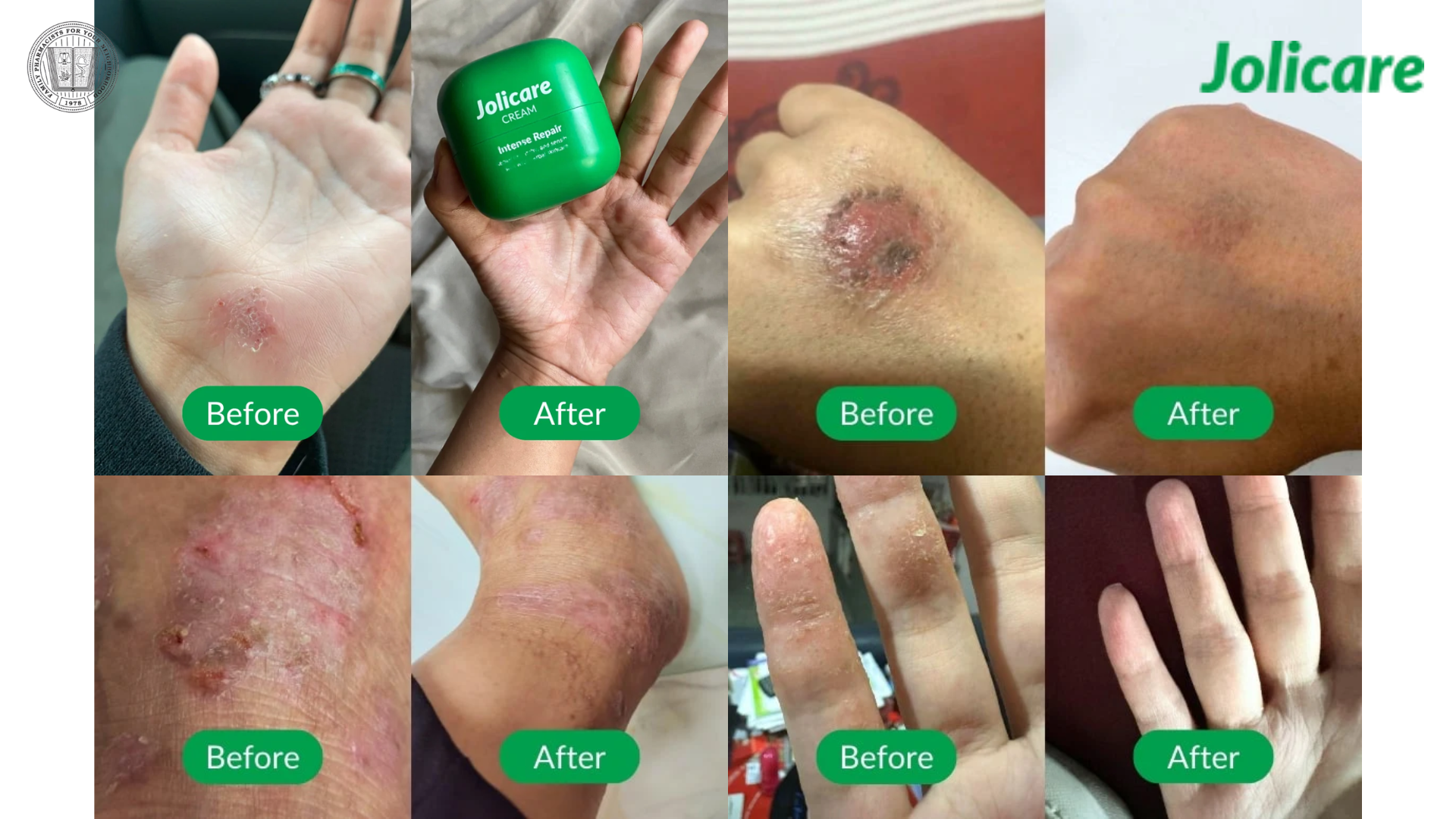 Jolicare Cream 50g + Jolicare Lotion 350ml | Intensif Repair untuk ...