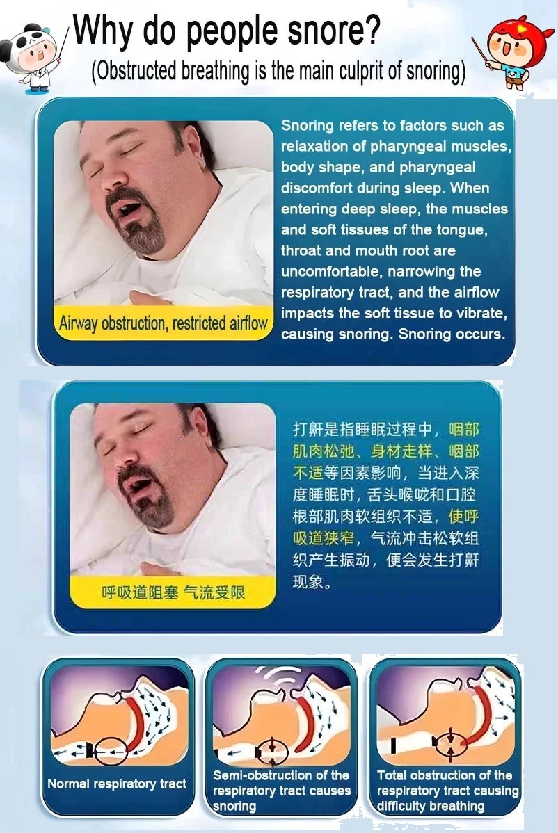 Japan Anti-Snoring Patch 打呼嚕止鼾贴 (1 Box = 12 Pcs) | Shopee Malaysia