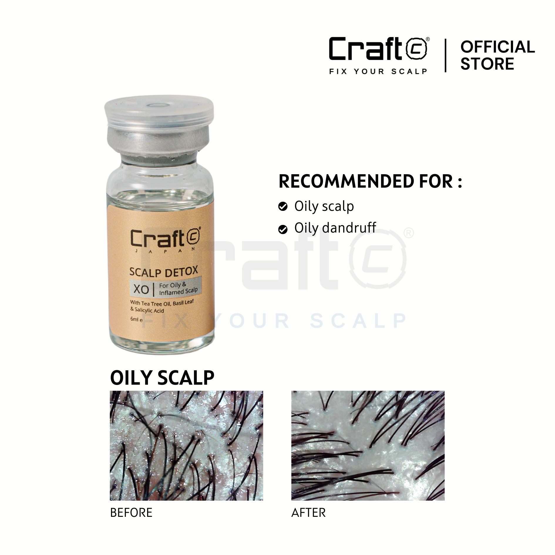 Craft Scalp Detox Extra Oily (XO) | Shopee Malaysia