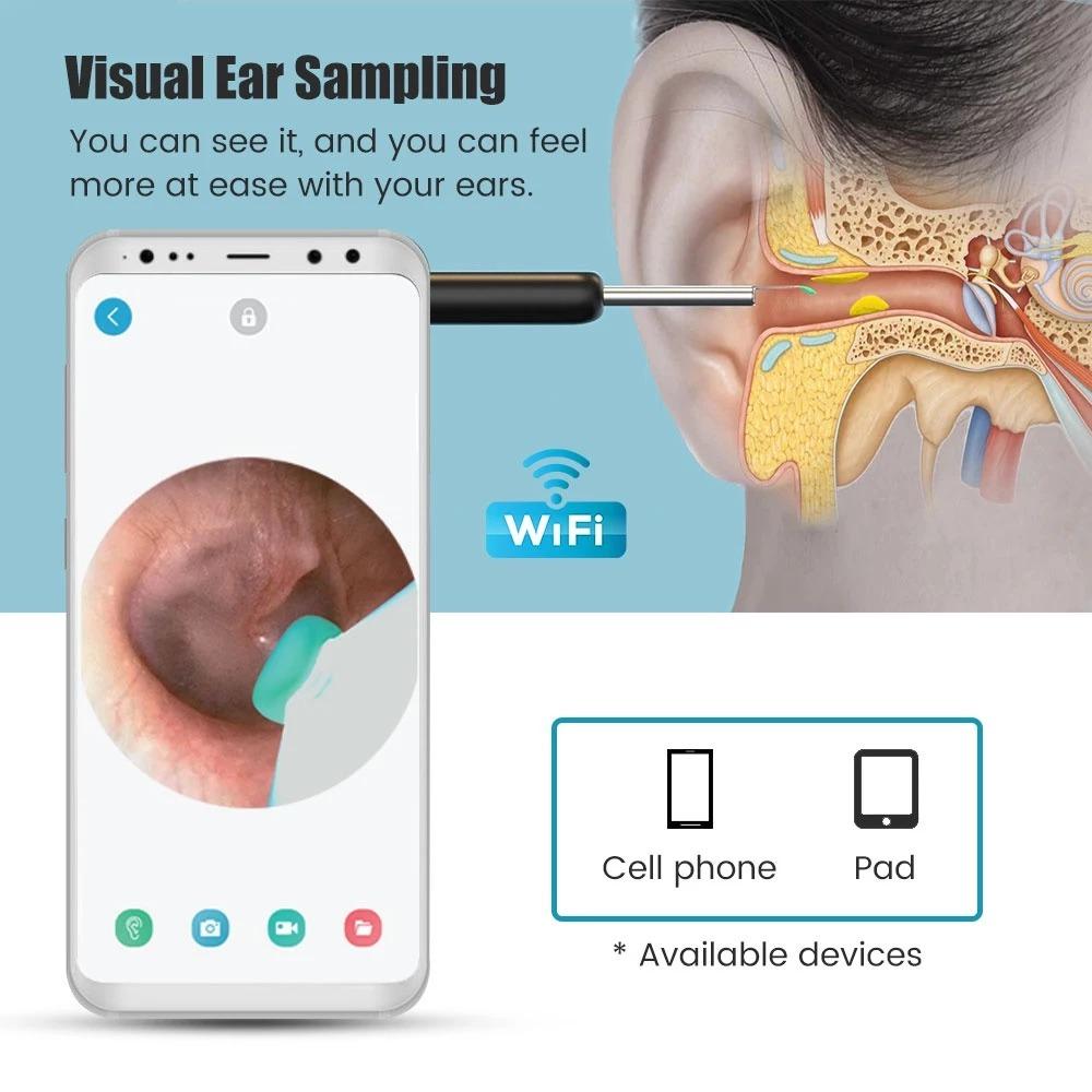 Smart Visual Earpick with Camera – Otoscope Earwax Remover for Baby ...