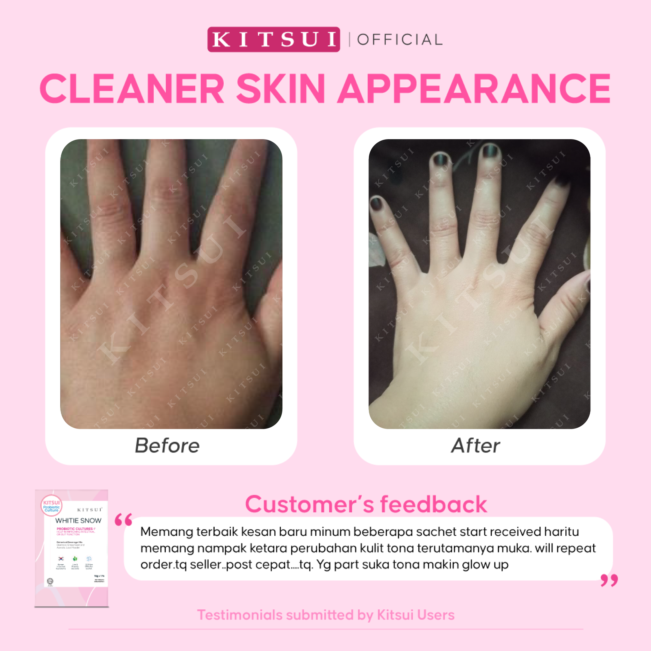 KITSUI Whitie Snow | 17's x 15g - Minuman Beri Probiotik + Niacinamide ...