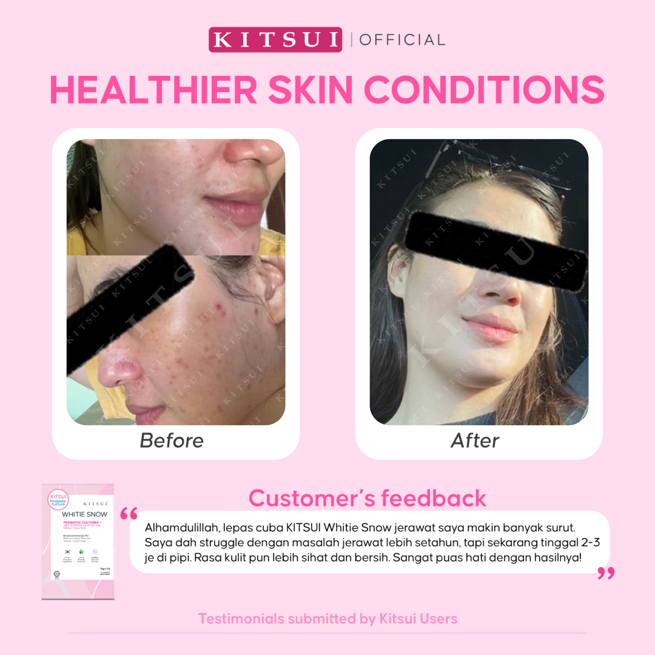 KITSUI Whitie Snow | 17's x 15g - Minuman Beri Probiotik + Niacinamide ...
