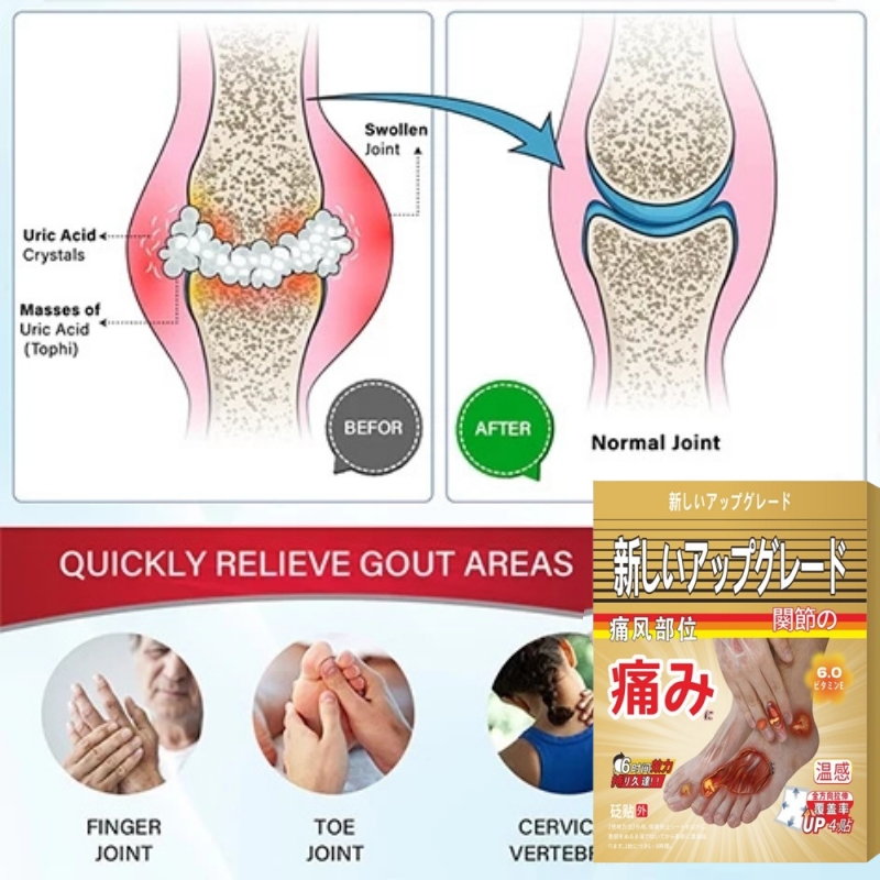 mitsui gout patch joint pain relief patch ubat gout sakit lutut dan ...