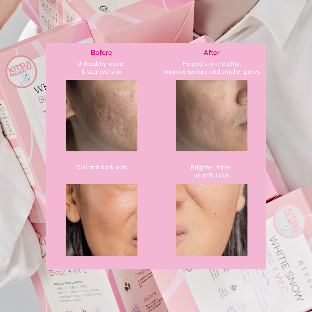 KITSUI Whitie Snow | 17's x 15g - Minuman Beri Probiotik + Niacinamide ...