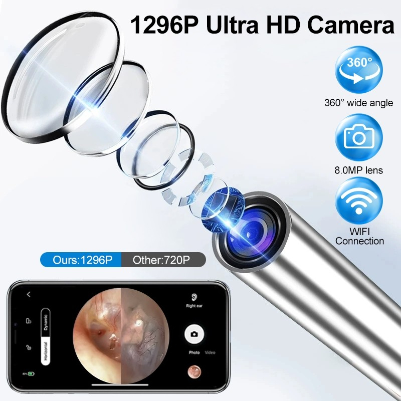 15-in-1 Y38 Smart Visual Ear Picker Kit with 2.5mm Earpick & Otoscope ...