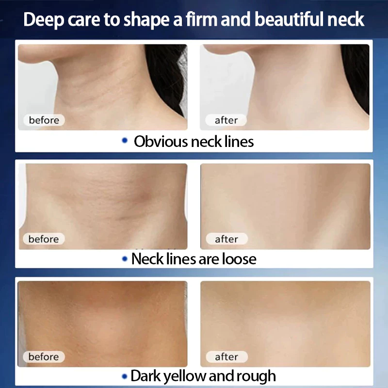 Neck Mask Remove neck lines, Anti Aging, Moisturizing and Whitening ...