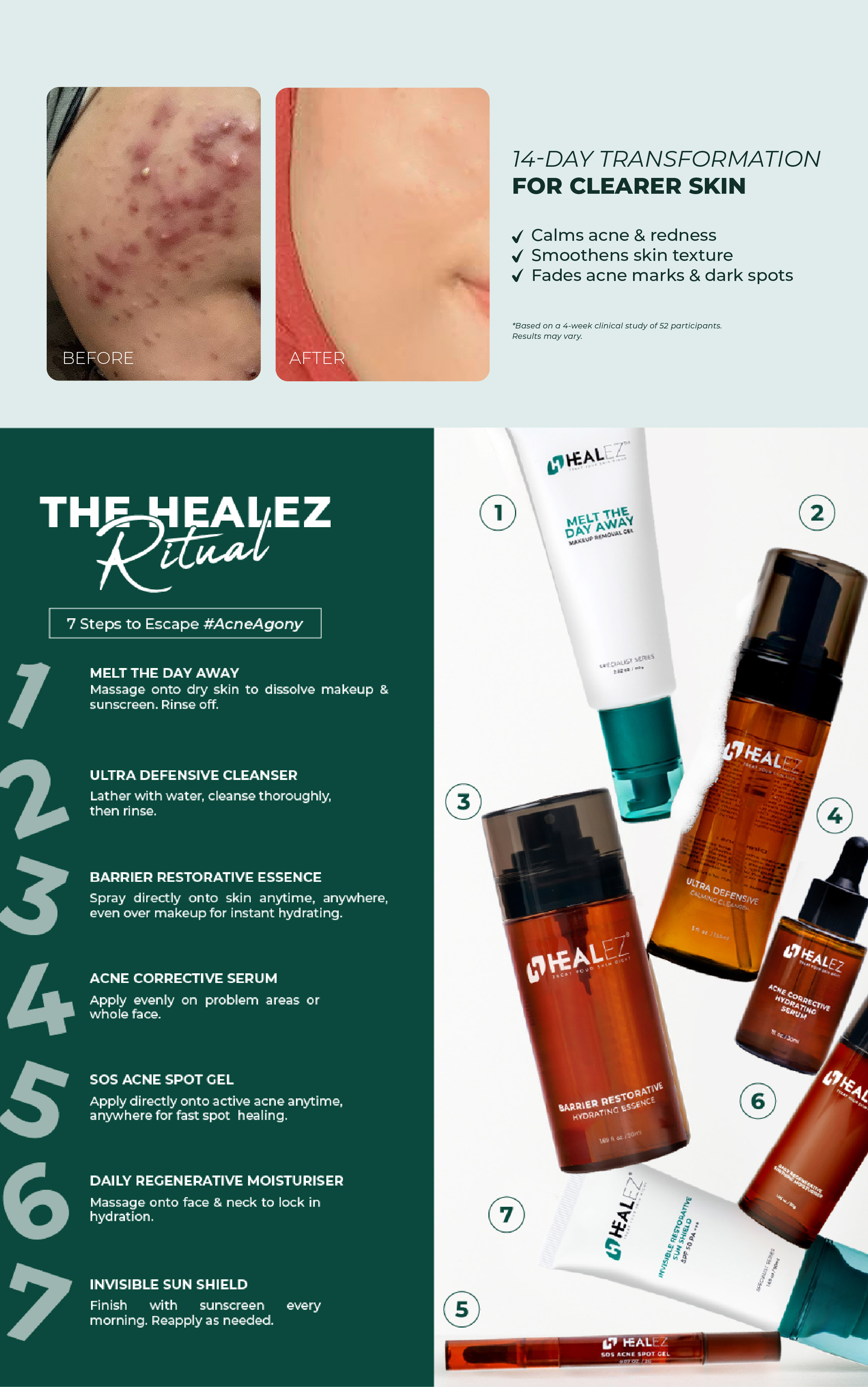 HEALEZ Acne Corrective Hydrating Serum (30ml) | Shopee Malaysia