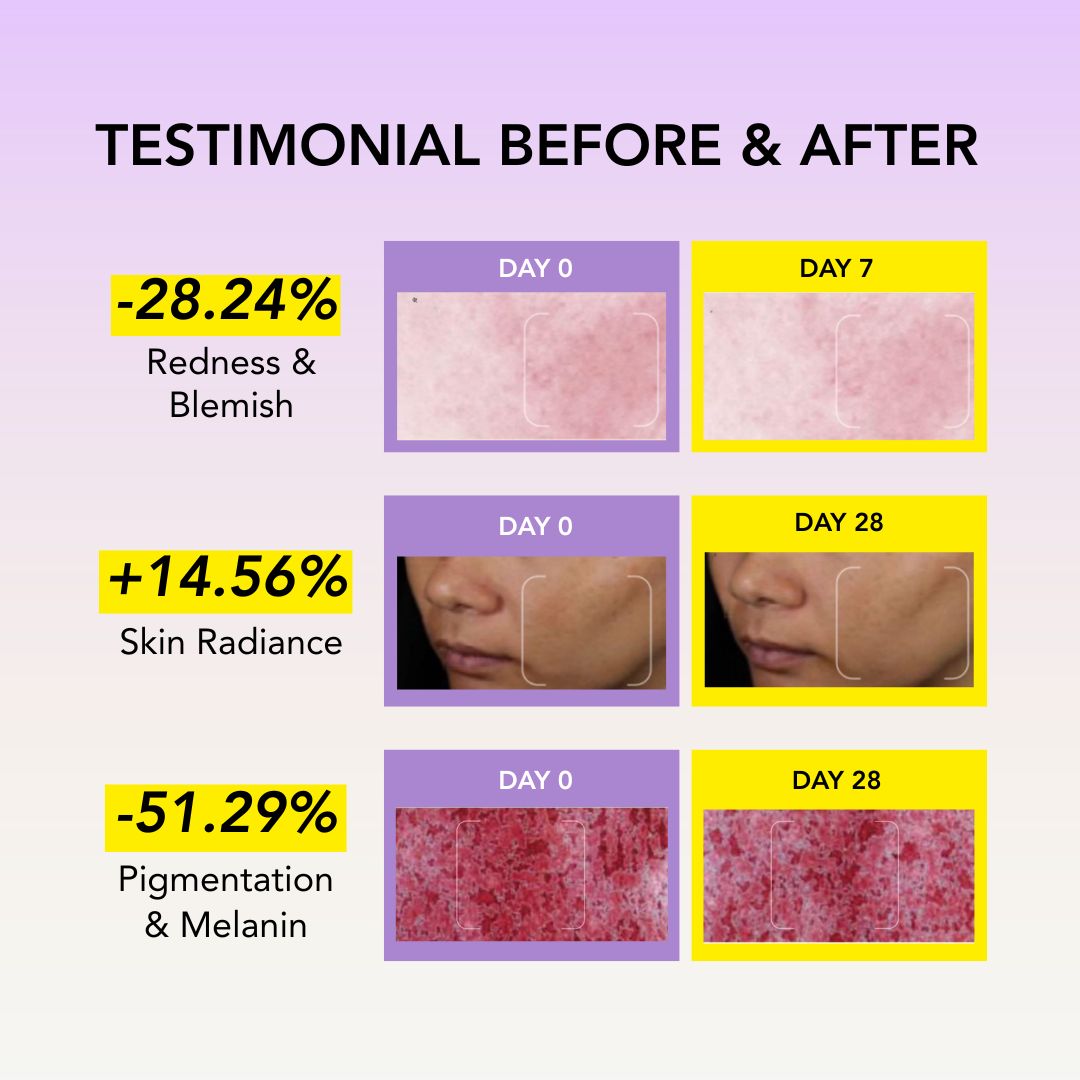 Inami Spot Block Essence 30ml Prevent and Block New Dark Spot | Reduce ...