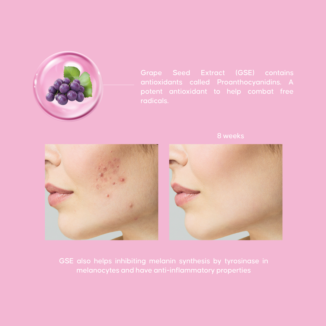 KITSUI Whitie Snow | 17's x 15g - Minuman Beri Probiotik + Niacinamide ...