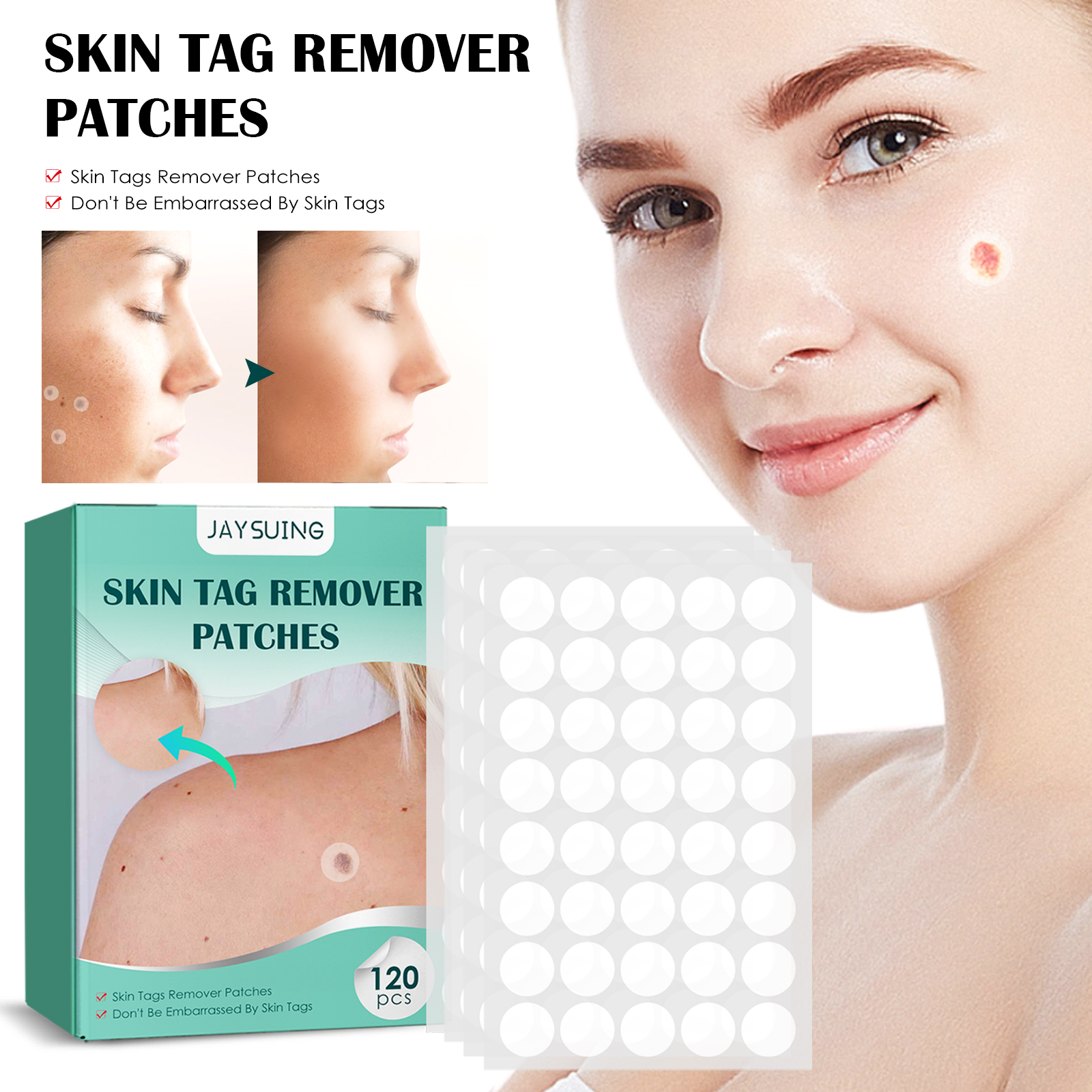 Warts Remover Patch 120pcs Skin Tag Remover Patch Skin Tags Treatment ...