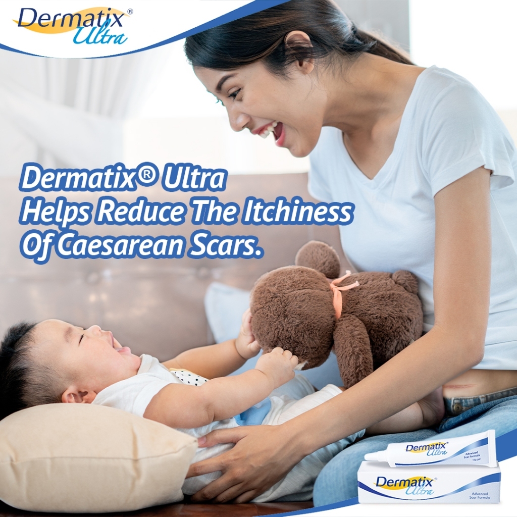 Dermatix Ultra Scar Gel 30g | Reduce Deep Scars & Post-surgery Scars ...