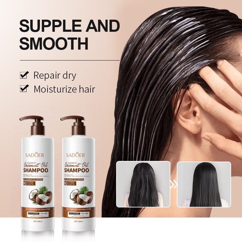 Coconut Oil Nourishing Shampoo Anti-Dandruff Kelemumur Ubat Relieve ...