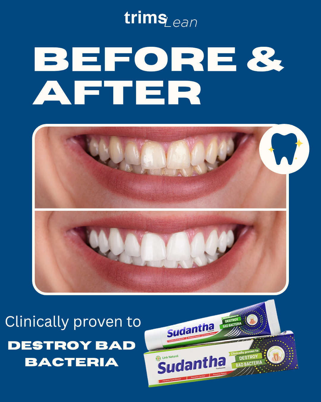 Sudantha Herbal Toothpaste - Ayurvedic Natural Toothpaste from Sri ...