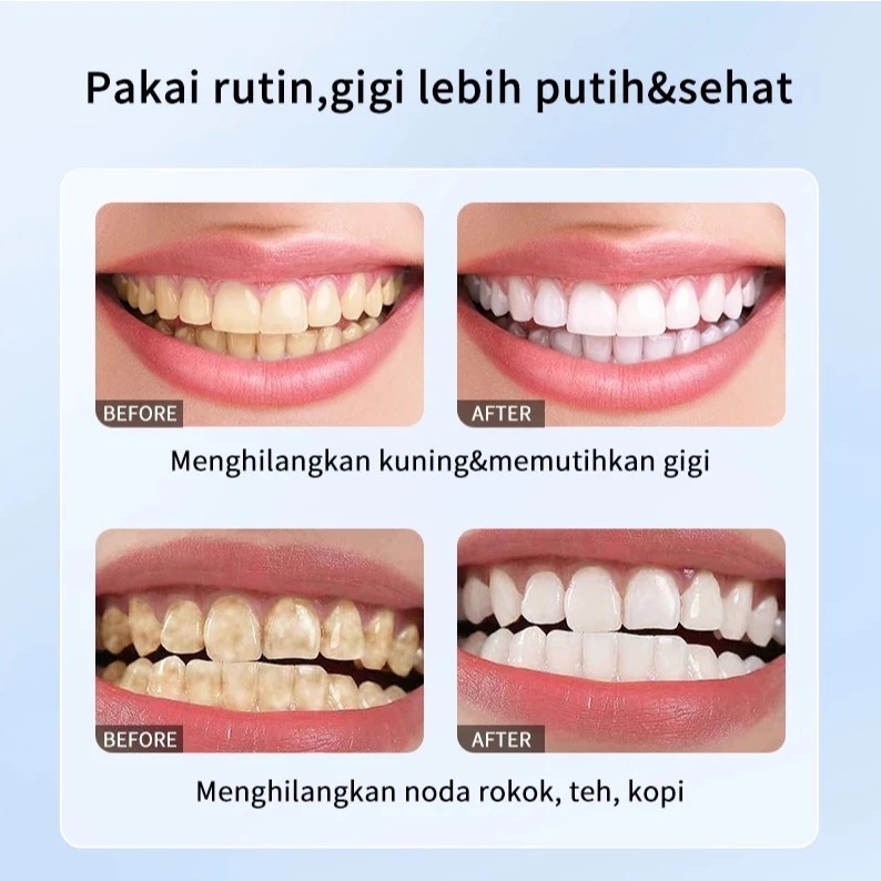 Body Accel Niacinamide Brightening Toothpaste | Ubat Gigi Mencerahkan ...