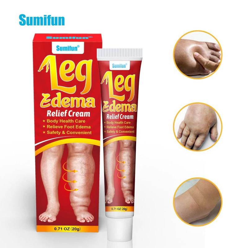 krim bengkak 20g leg edema cream ubat surut bengkak kaki membantu ...