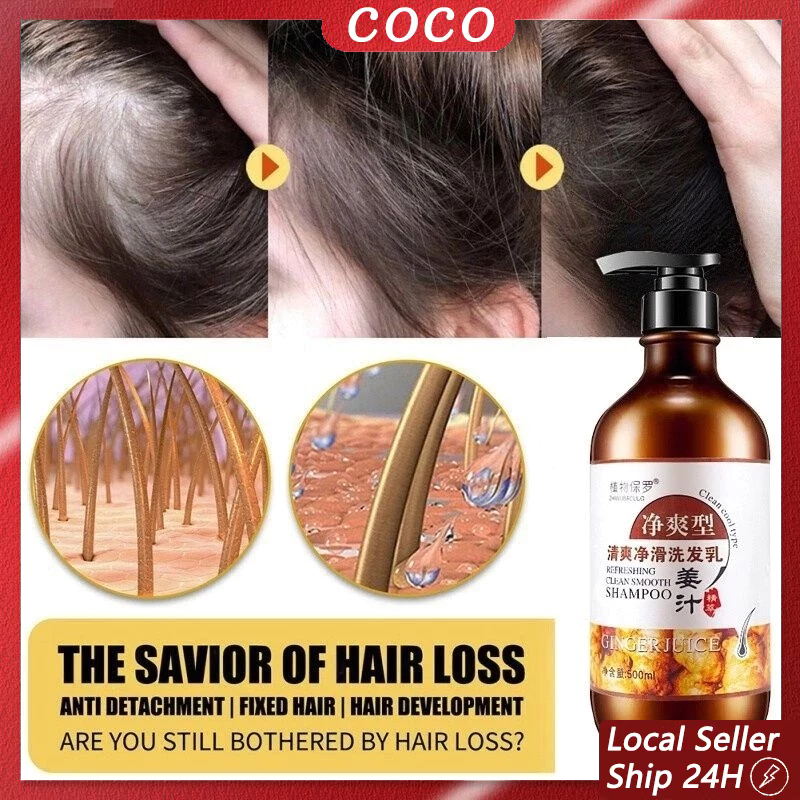 🔥HOT🔥Anti-hair loss shampoo-rambut gugur-hair fall shampoo Rambut ...