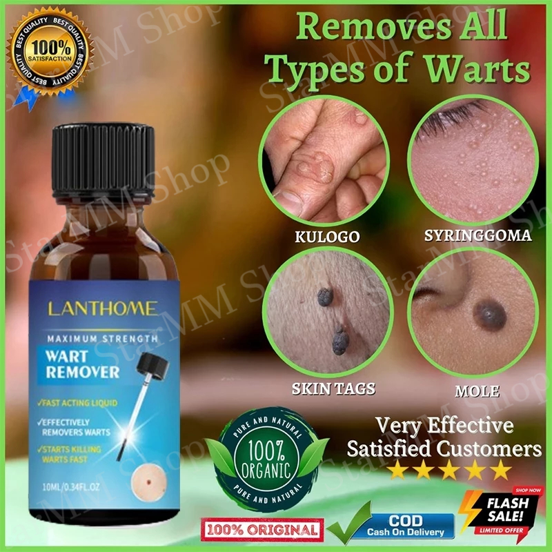 Ubat ketuat Wart Remover Ketuat remover Skin tag remover Mole remover ...