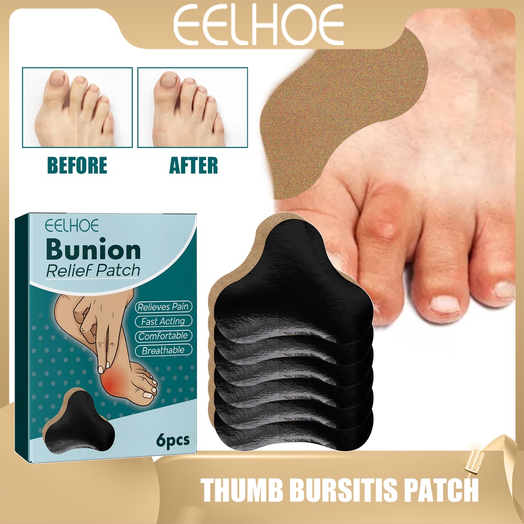 Eelhoe Finger Bunion Patch Toe Pain Relief Patch Strong Thumb Corrector ...