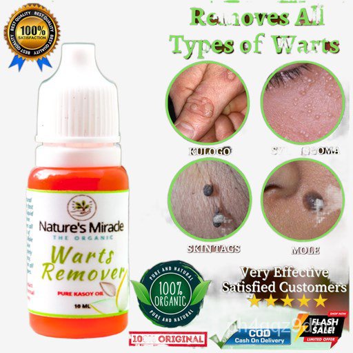 THE NEW Warts Remover Kasoy Oil Skin Tag Remover Mole Remover Warts ...
