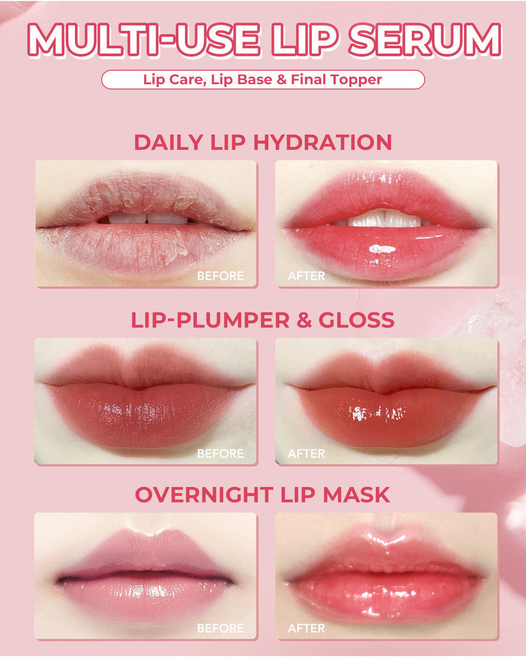 Y.O.U Simplicity Icy Glow Lip Serum | Hydrating|Moisturizing|Lip Care|Nourishing 3g | Shopee ...