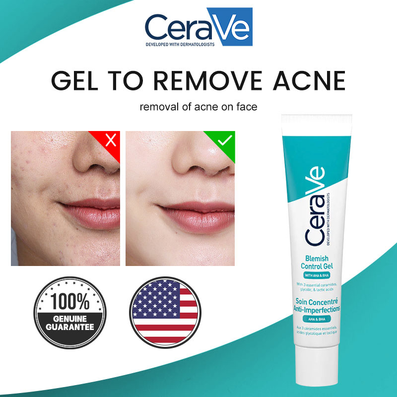 CeraVe Acne Control Gel, 2% SA Treatment watsons blackhead scar remover ...