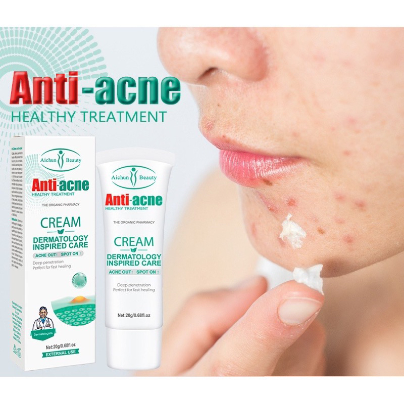 Anti-acne cream acne remover treatment brightening moisturizing skin ...