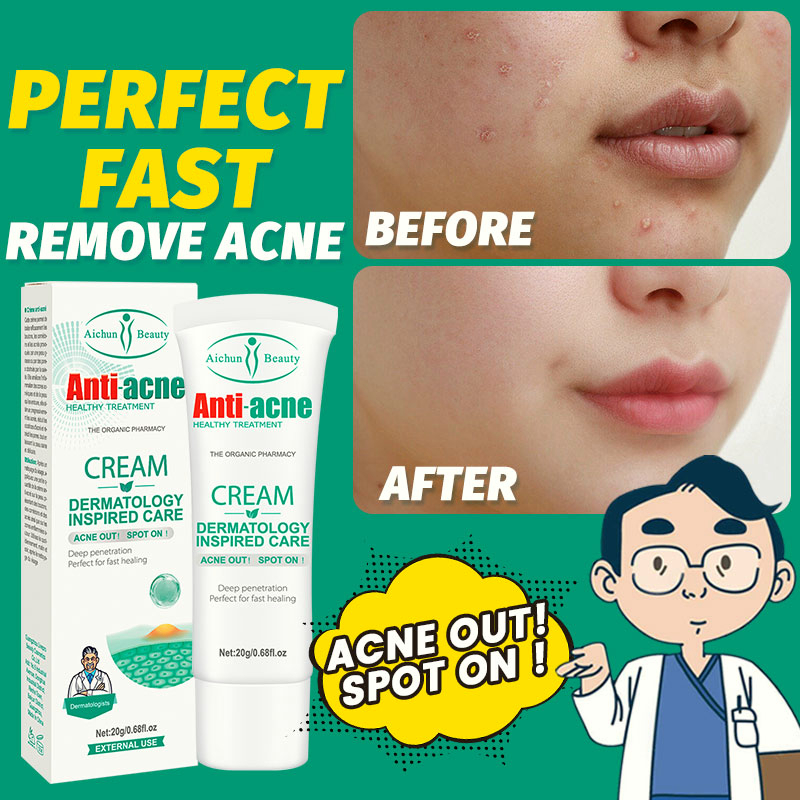 Acne remover cream Pimple eraser Pimple marks remover Pore minimizer ...