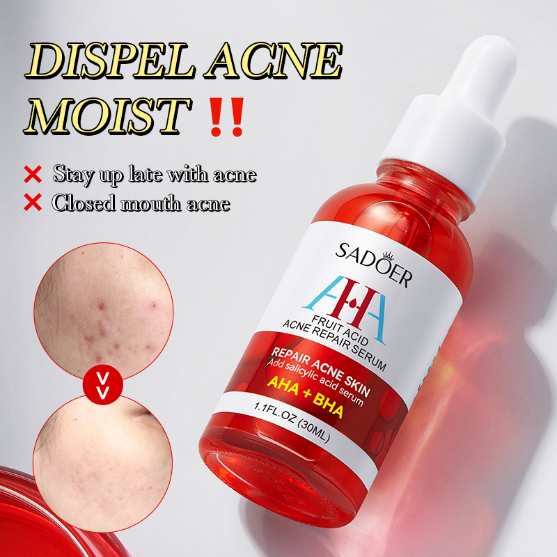 Acne Spot Treatment Soothing Serum for Pimples Scar Repair Shrink Pores ...