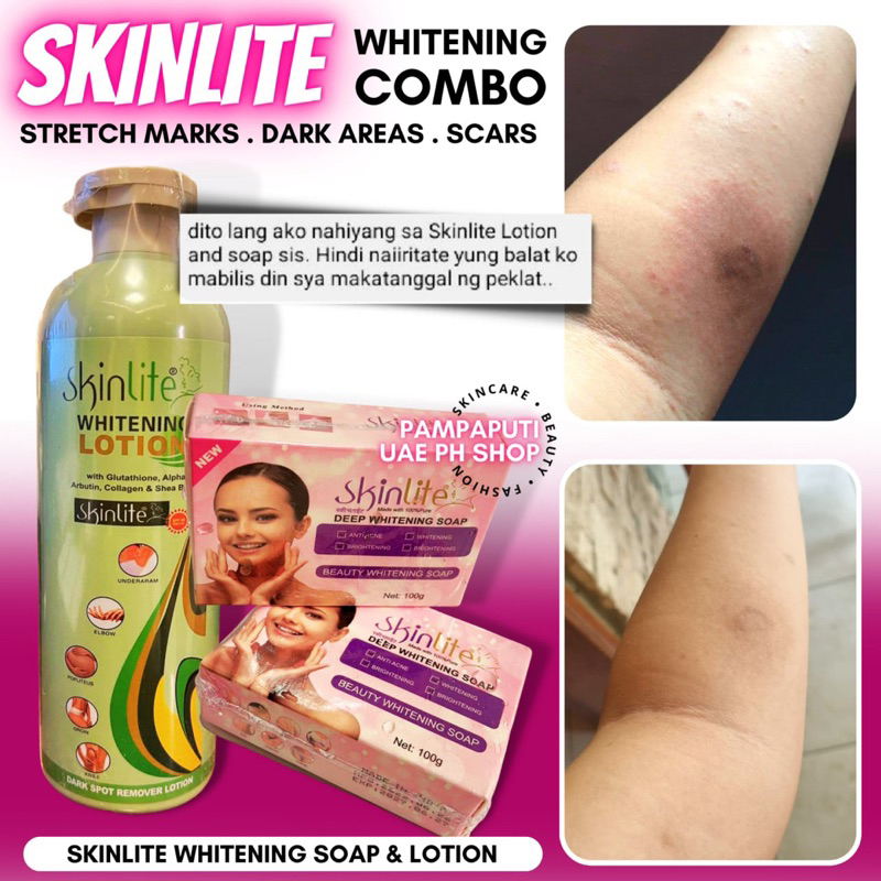 Skinlite whitening Soap and Body lotion | Shopee Malaysia